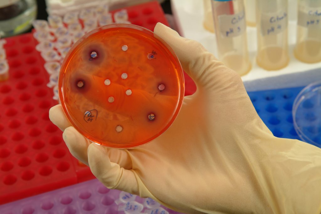 Enzyme Technology Research Team – BIOTEC