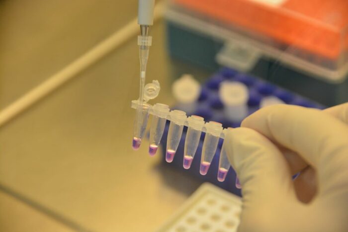 Bioengineering and Sensing Technology Research Team – BIOTEC